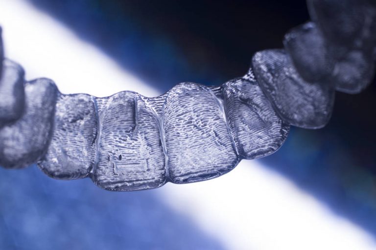 Aligned Teeth Will Make You Look More Presentable - She Knows